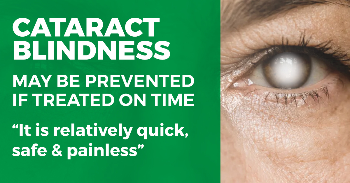CATARACT BLINDNESS MAY BE PREVENTED IF TREATED ON TIME - Hashmanis ...